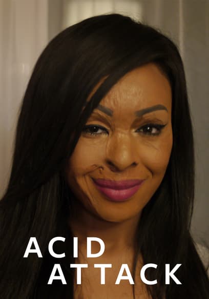 Watch Acid Attack (2018) - Free Movies | Tubi